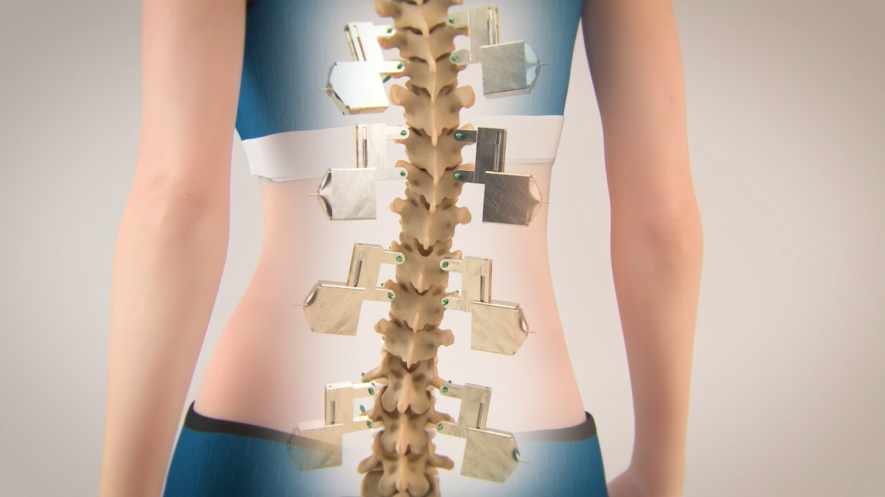 Teslake - Supporting fundraising activities